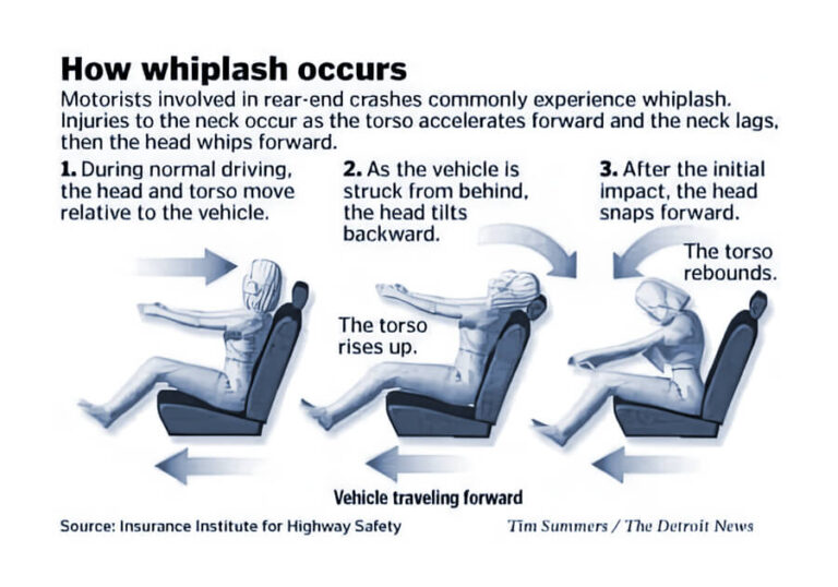 What Is a Typical Whiplash Settlement Amount in Texas? - Genthe Law ...